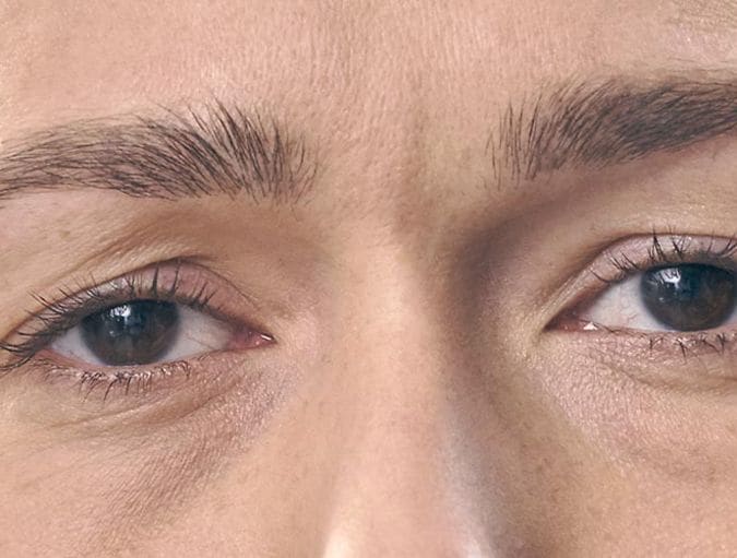 Congiuntivite: sintomi, cause e come curarla | GrandVision